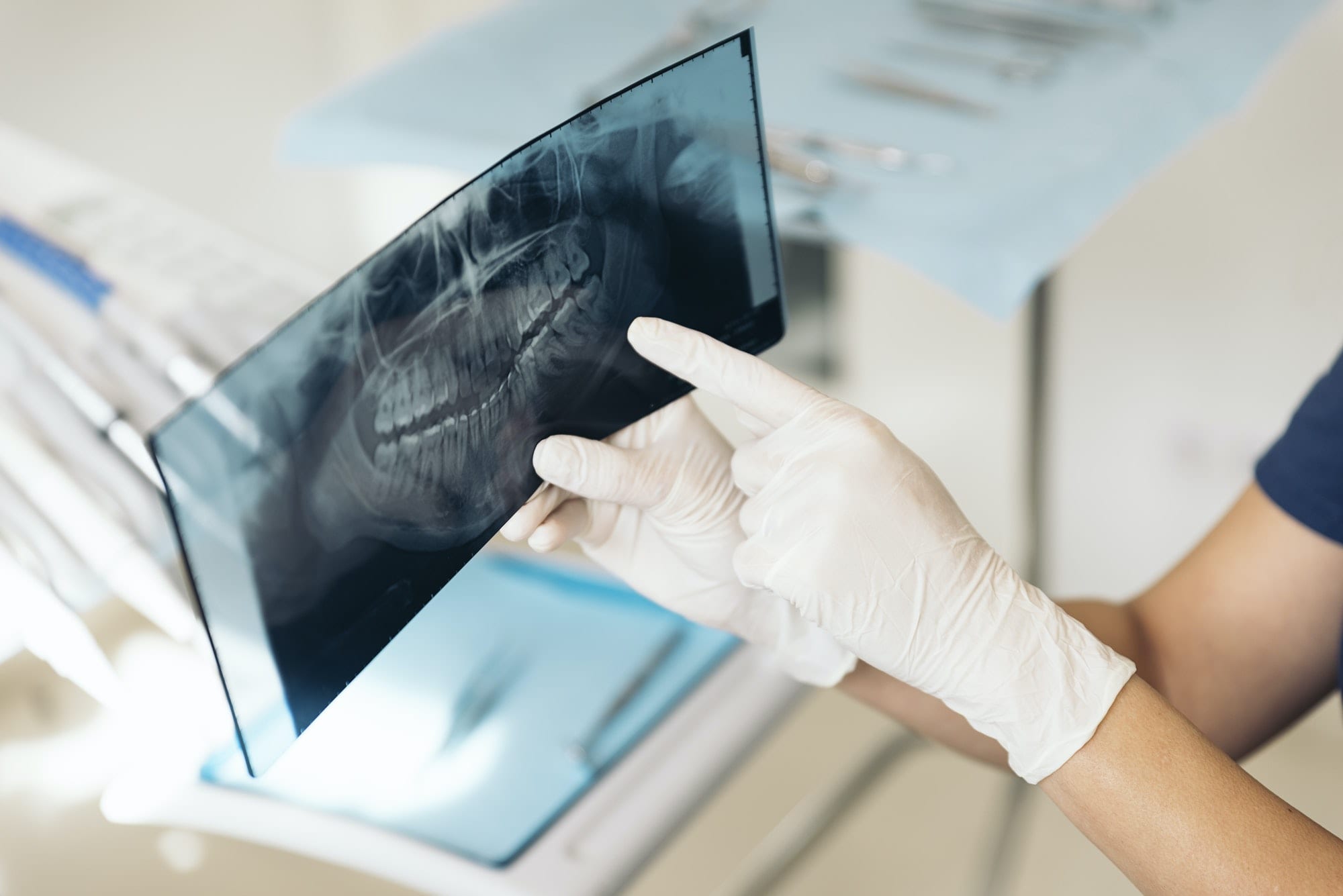Initial Exam and Radiographs in Parker and Glendale